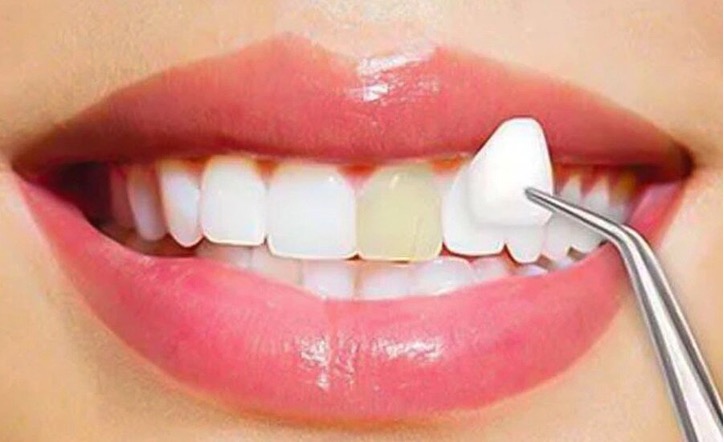 How Cosmetic Dentistry Can Enhance Your Life · Center for Specialized ...